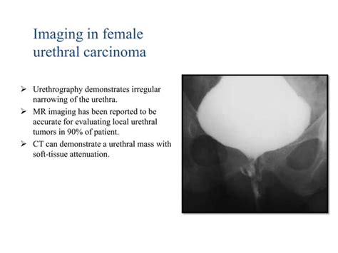rgu retrograde urethrogram mcu micturating cystourethrogram and