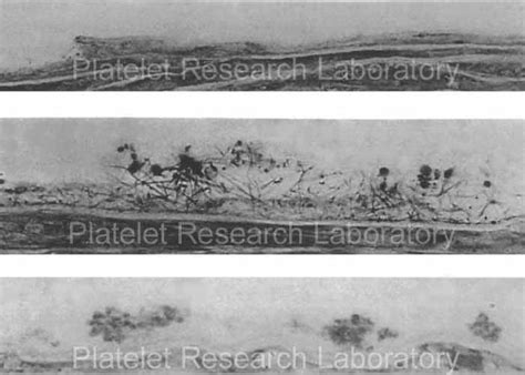 Scientific Interest Platelet Research Laboratory