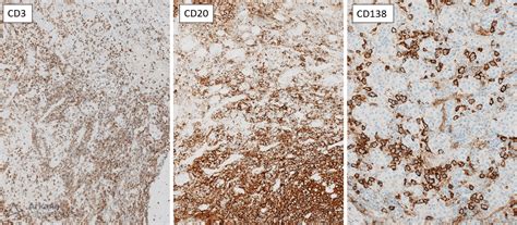 Pituitary Lesion Arkana Laboratories
