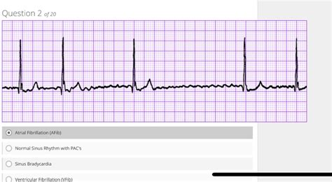 Question 2 Of 20 Atrial Fibrillation Afib Normal Sinus Rhythm With Pacs Sinus Bradycardia