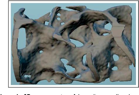 Figure 1 From The Dependence Of Broadband Ultrasound Attenuation On
