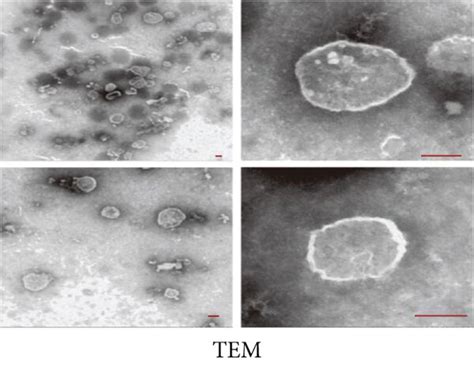 Extraction Of Mesenchymal Stem Cell Membrane A Tem Image Of