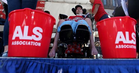 What Is Als Experts Explain Symptoms To Look Out For Causes And Treatments Cbs News