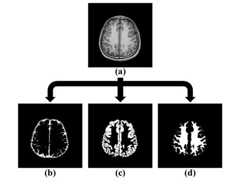 Segmentation Of Csf Gray Matter And White Matter Image Process By Download Scientific Diagram