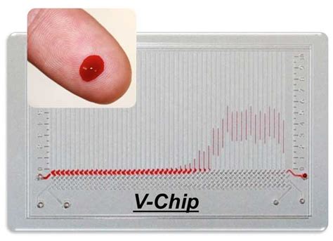 V Chip Pocket Test Measures 50 Things In A Drop Of Blood Robaid