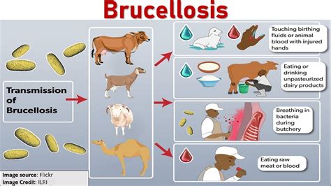 Brucellosis Awareness Protecting Your Health Livestock Zoonosis