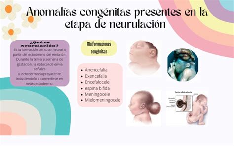 Anomalías Congénitas Presentes En La Etapa De Neurulación Pdf