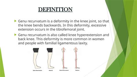 Genu Recurvatum Deformity Of The Knee Joint Ppt