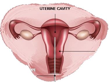 Gynaecology Services Lakshmifertility
