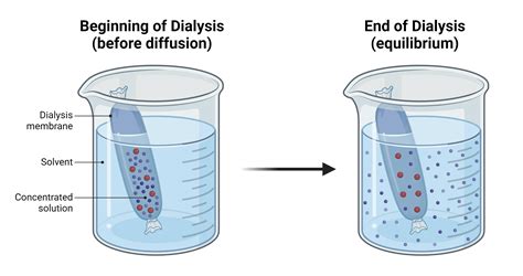 Dialysis Center