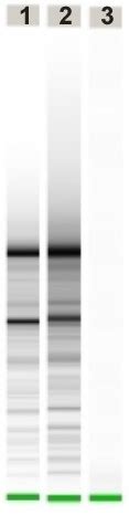 Results Of RNA Integrity Testing By A Agilent Bioanalyzer Using Download Scientific