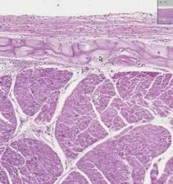 Purkinje Cells Histology