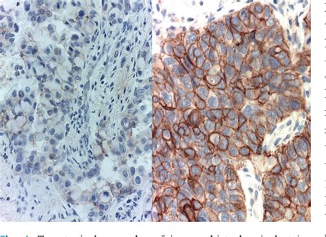 [pdf] Predictive Biomarkers Of Response For Pd 1 Pd L1 Inhibitors A Cumbersome Gold Rush