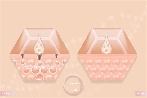 히알루론산 전후의 모발 및 피부 용액 광고 핑크 콜라겐 세럼 드롭을 화장품 광고 배경으로 피부 세포 위에 떨어 뜨려 사용할 준비 일러스트 벡터 Dna에 대한 스톡 벡터 아트