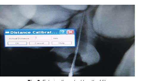 Figure 2 From Comparative Evaluation Of Electronic Apex Locators And Radiovisiography For