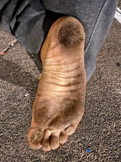 Dirty Rough Soles After A Long Day Barefoot 👣 Rroughmalefeet