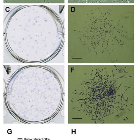 Characterization Of Human Bulk Cultured Gingival Fibroblasts Gfs And Download Scientific