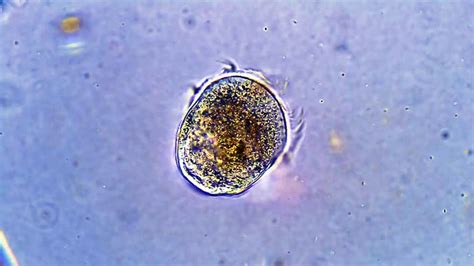 Entamoeba Histolytica Under Microscope