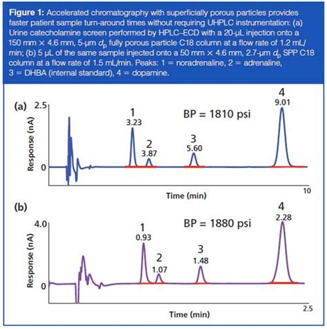 Positive Impacts Of Hplc Innovations On Clinical Diagnostic Analysis