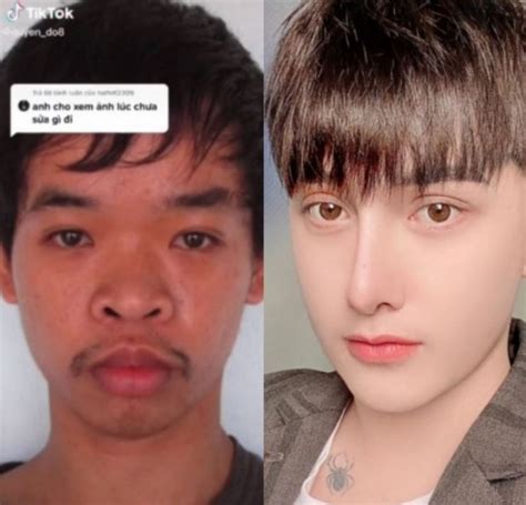 부모님도 못알아봐” K아이돌 성형한 베트남 남성 서울신문