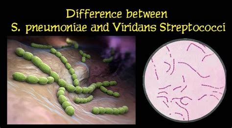 Difference Between S Pneumoniae And Viridans Streptococci