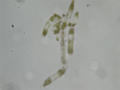 Have You Ever Seen This Phytoplankton ResearchGate