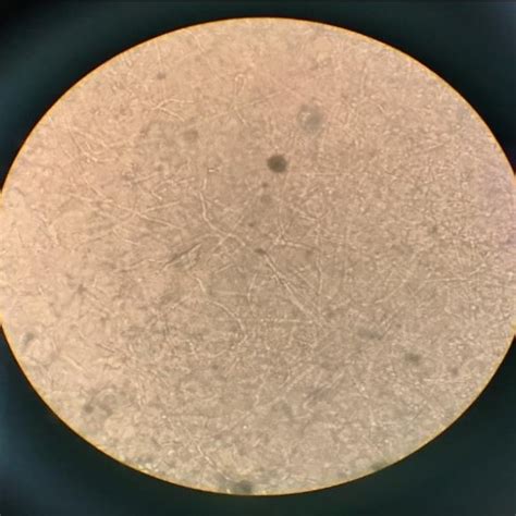 Gram Staining Showing Numerous Pus Cells With Intracellular Download Scientific Diagram