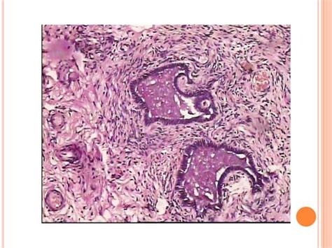 0102 Ambiguous Genitalia Case Presentationppt