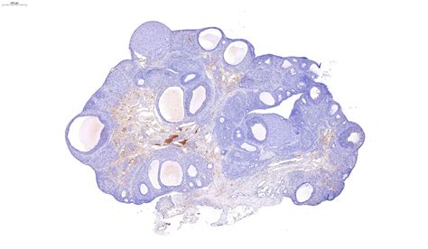 免疫组化染色 卵巢