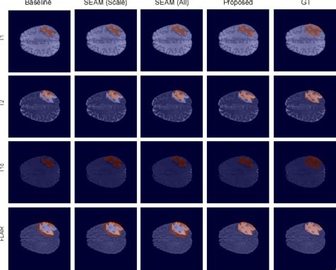 Figure 6 From Weakly Supervised Segmentation With Cross Modality