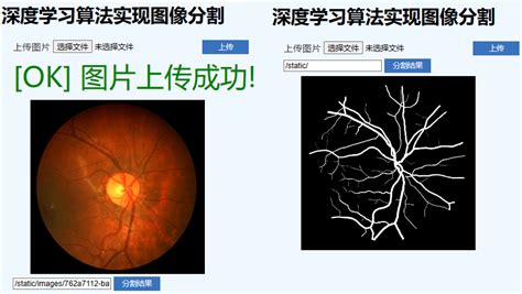 Django搭建图像分割的页面 51cto学堂 掌握django与unet模型实现眼底血管图像分割