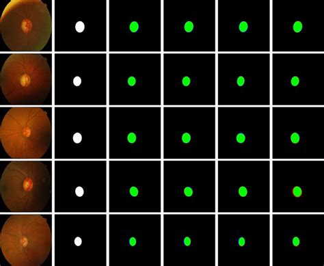 sample segmentation results of the four different networks on the