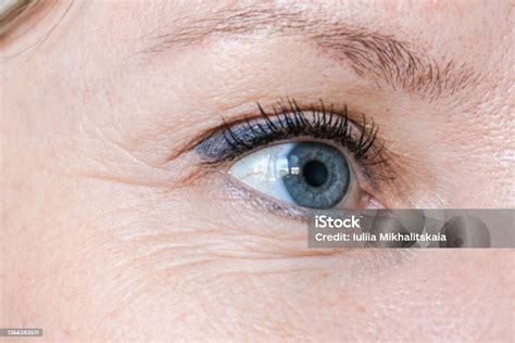 여성의 얼굴 치료 전 눈 주름 생체 재생 얼굴 리프팅 및 안료 반점 제거의 응력 학적 절차를 젊어지게한 결과 40 44세에 대한 스톡 사진 및 기타 이미지 Istock