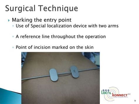 Endoscopic Spinal Surgery Pptx Physical Therapy Wellness