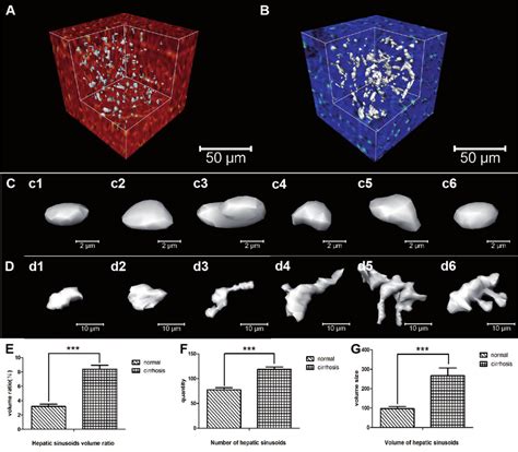 3d Volume Rendering And Quantitative Analyses Of Hepatic Sinusoids In