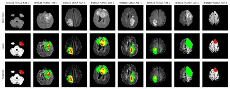 first row 7 slices of an input mri data second and third rows the