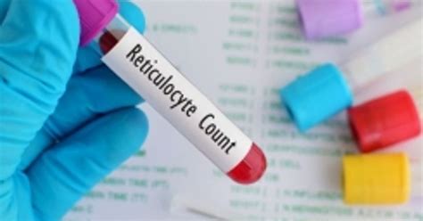 What Are Reticulocytes Facty Health