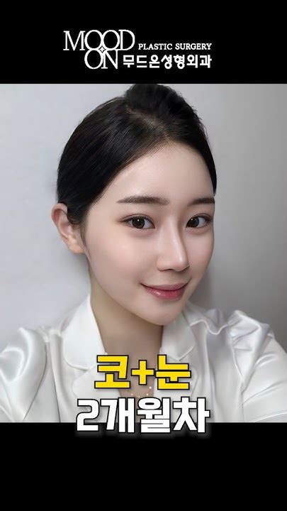 스튜어디스 지망생의 눈코 성형전후 Shorts Youtube