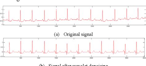 Figure 1 From Arrhythmias Classification Based On Cnn And Lstm Attention Hybrid Model Semantic