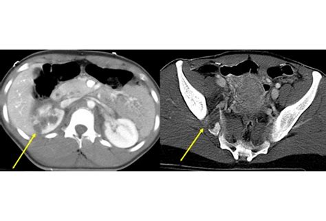 Triaging Polytrauma Slideshow