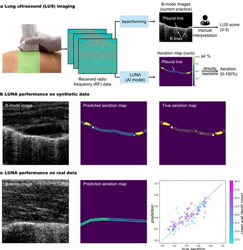 [논문 리뷰] Ultrasound Lung Aeration Map Via Physics Aware Neural Operators