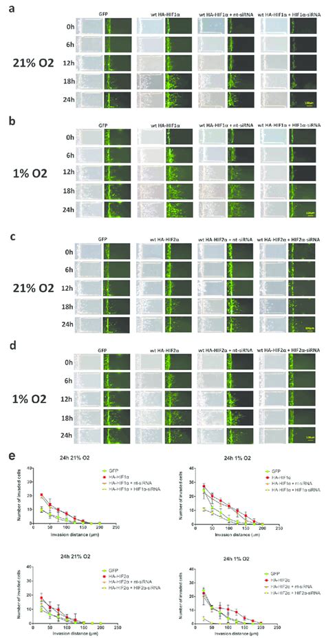 Time Course Microfluidic Chip Migration Assay Of U87 Glioma Cells Download Scientific Diagram
