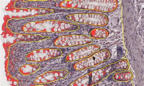 Help Using Cellprofiler For Ihc Tissue Analysis Image Analysis