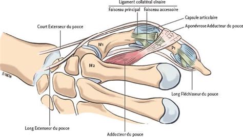 Entorse De Larticulation Métacarpo Phalangienne Du Pouce Avec Lésion Du Ligament Collatéral