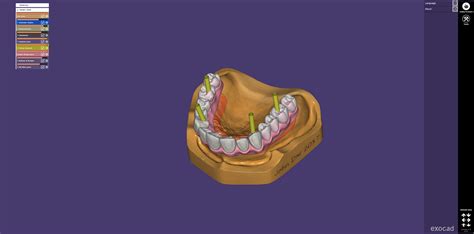 Exocad Viewer Exocad Dentalcad Smart Optics