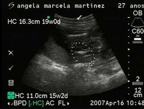 Our Baby Guess The Sex Before The Dr YouTube