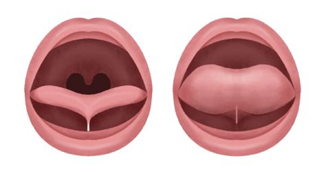 Tongue Movement Patterns For Feeding Hallie Bulkin