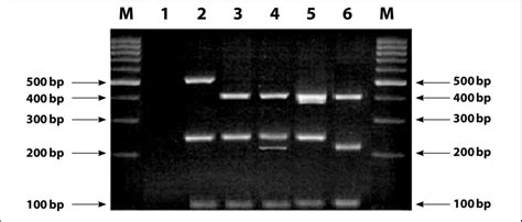 A Multiplex Pcr Rflp For The Simultaneous Detection Of Fvl And