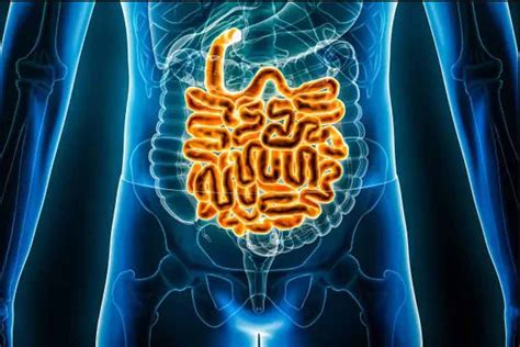 Small Intestine Bleeding Klarity Health Library