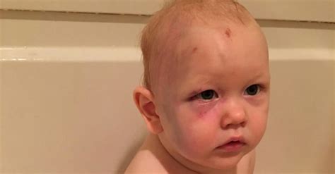 Babysitter Gets Away With Abusing Baby Popsugar Moms